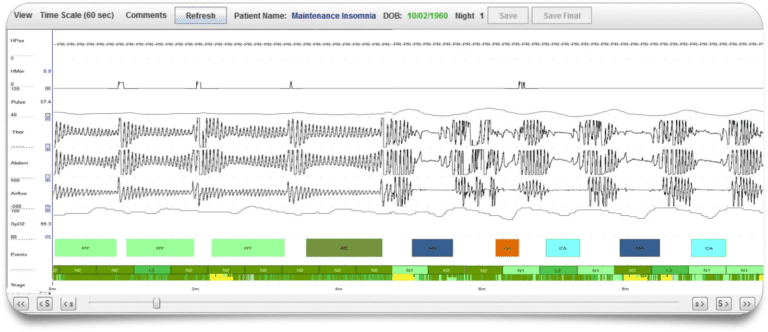 Sleep Profiler PSG2 – BMedical